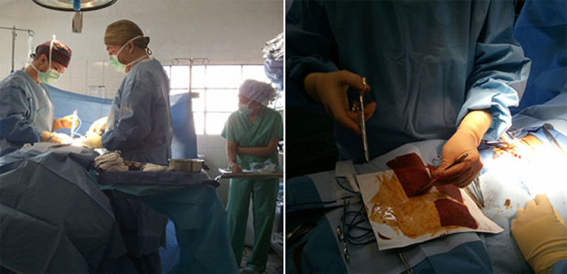 Mission Trips – SURGIMESH® Surgical Implants